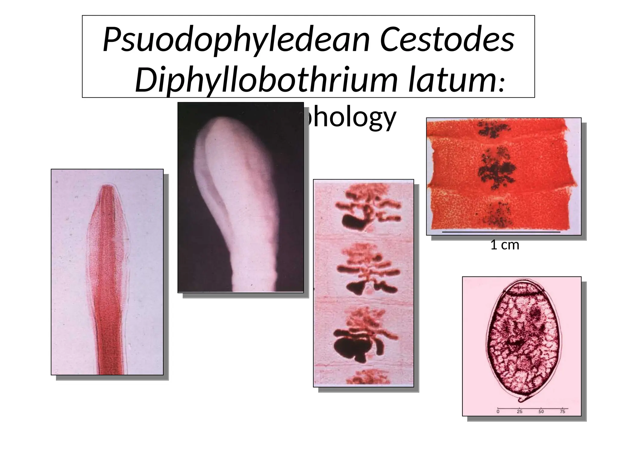 CESTODES & TREMATODES SLIDES FOR LEARNING PURPOSE PRACTICAL | PPT