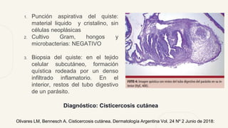 cestodiasis : Taeniasis y cisticercosis. | PPTX