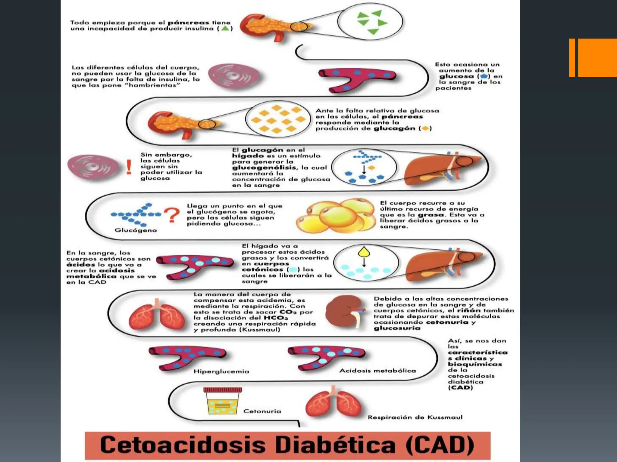Cetoacidosis Diabetica, manejo en urgencias medicas | PPTX | Diabetes ...
