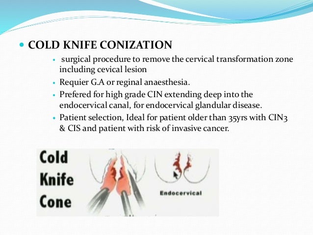 Cevical intraepithelial neoplasia