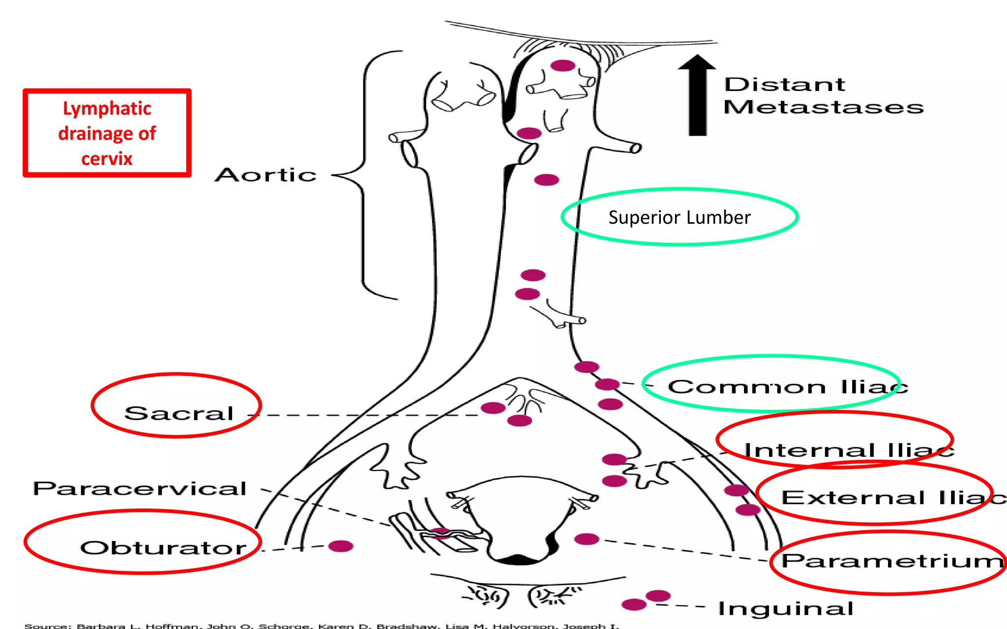 Cevical intraepithelial neoplasia & screening ppt | PDF