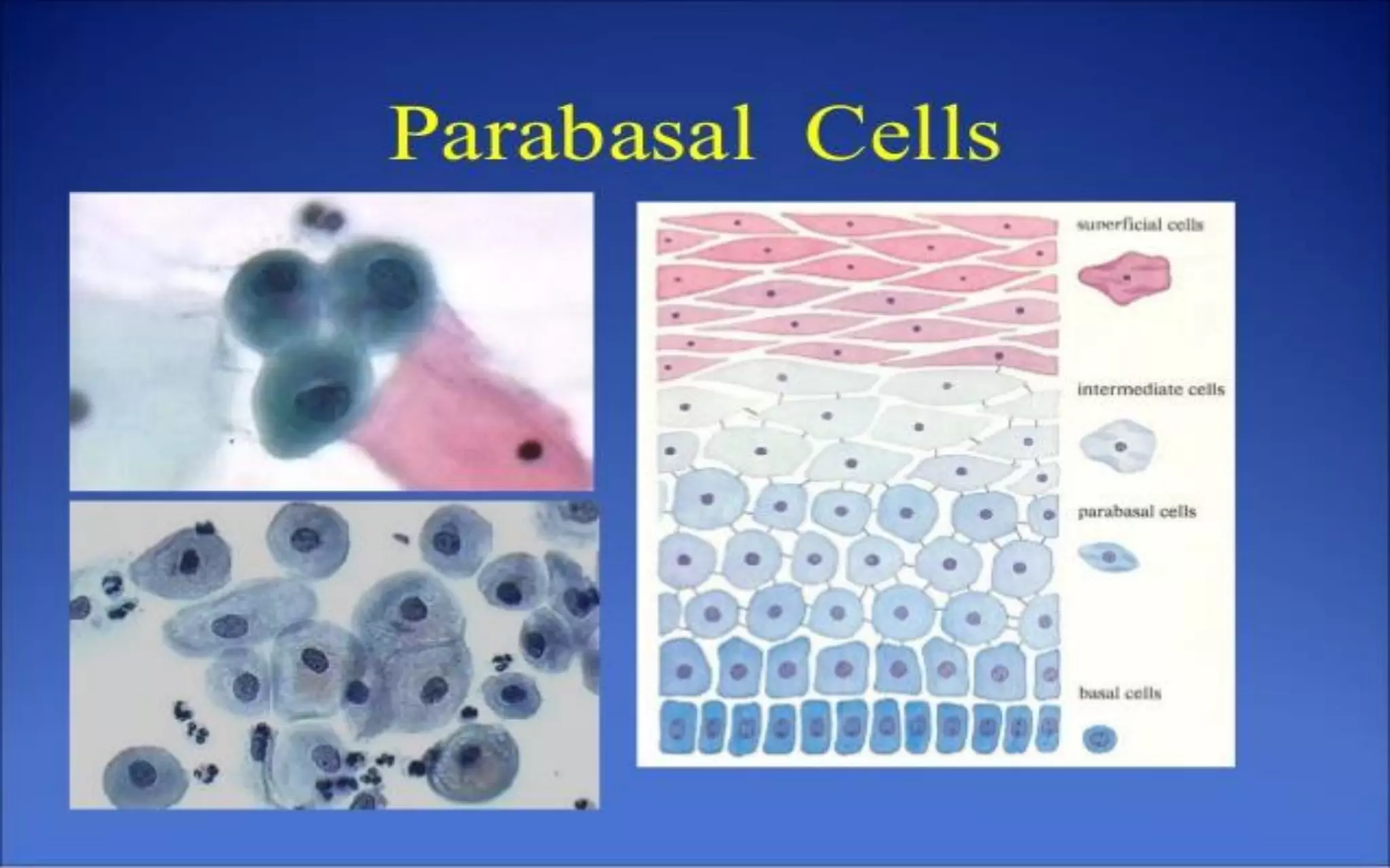 Cevical intraepithelial neoplasia & screening ppt | PDF