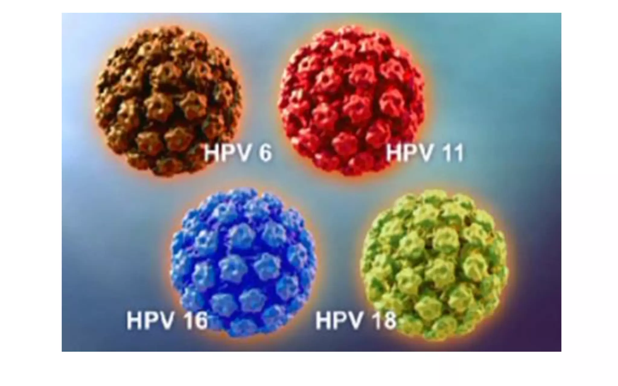 Cevical intraepithelial neoplasia & screening ppt | PDF
