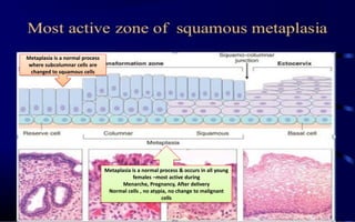 Cevical intraepithelial neoplasia & screening ppt | PDF