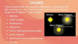 CEVS- flashes and halos .ppt