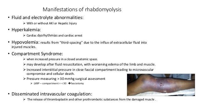 rhabdomyolysis 2016