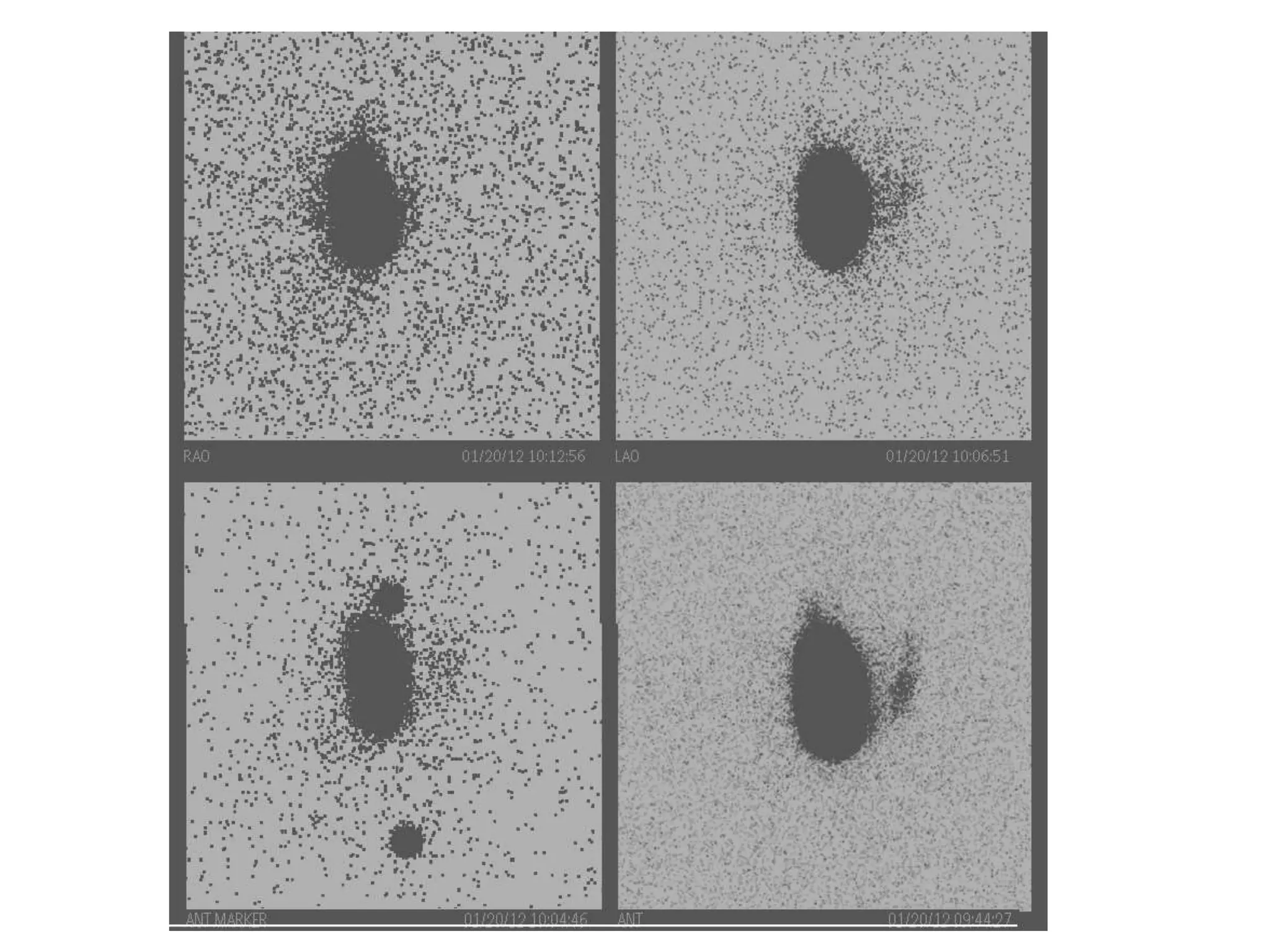 Nuclear medicine thyroid imaging | PPTX
