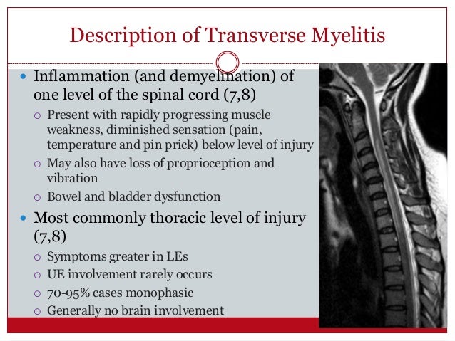Transversemyelitis2