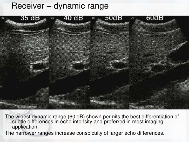 Basic physics of ultrasound.JH