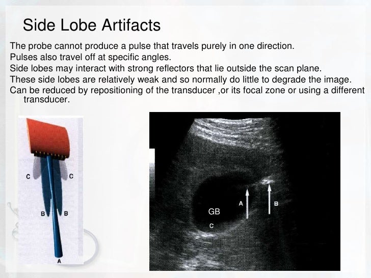 Basic physics of ultrasound.JH