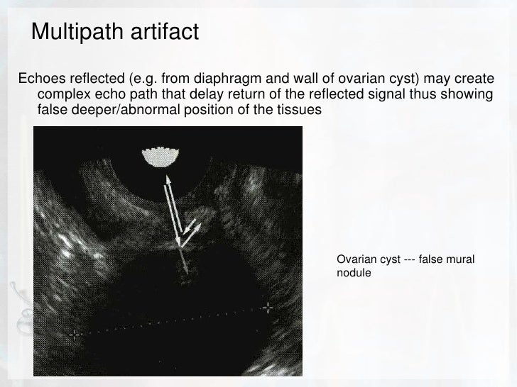 Basic physics of ultrasound.JH