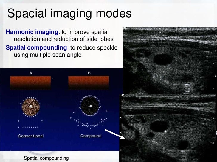 Basic physics of ultrasound.JH