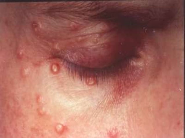 Common Skin Diseases | PPT | Skin and Dermatology | Diseases and Conditions