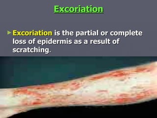 Common Skin Diseases