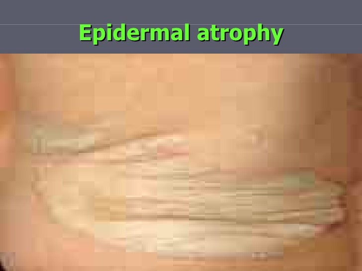 Common Skin Diseases