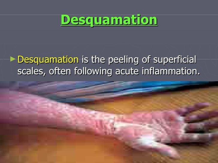 Common Skin Diseases