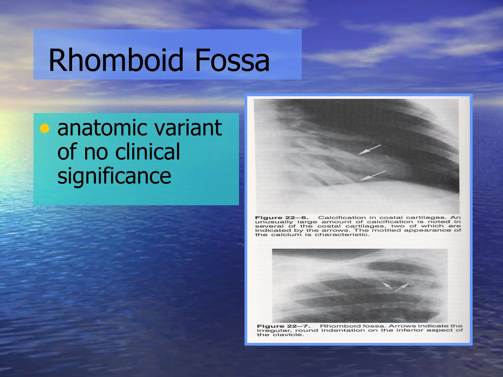 BASIC RADIOLOGY | PPT