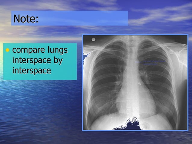 BASIC RADIOLOGY | PPT