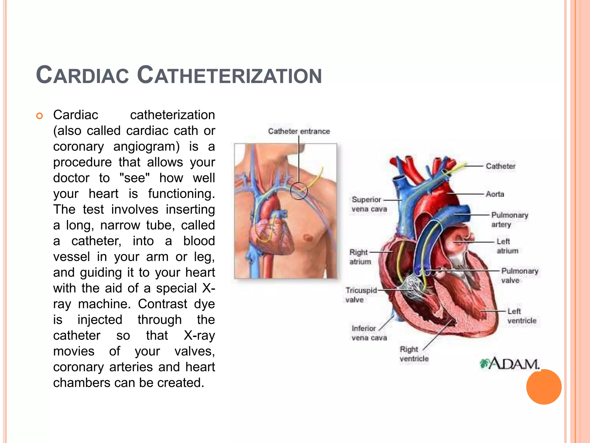 Diagnostic Procedures for Cardiovascular system | PPTX