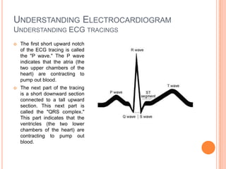 Diagnostic Procedures for Cardiovascular system | PPTX
