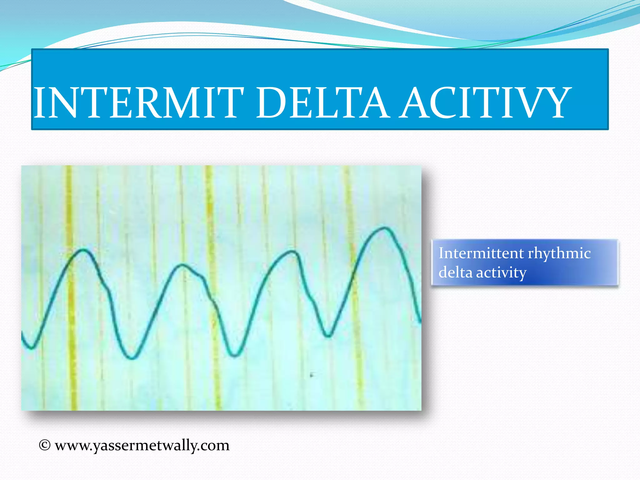 Issues in brainmapping...The secrets of conventional EEG | PPTX