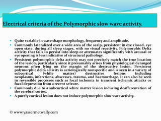 Issues in brainmapping...The secrets of conventional EEG | PPTX