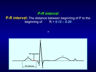 Essentials Of Ecg | PPT