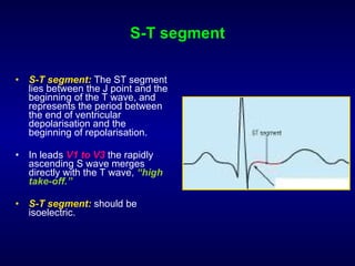 Essentials Of Ecg | PPT