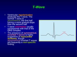 Essentials Of Ecg | PPT