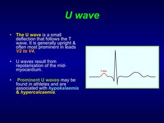 Essentials Of Ecg | PPT