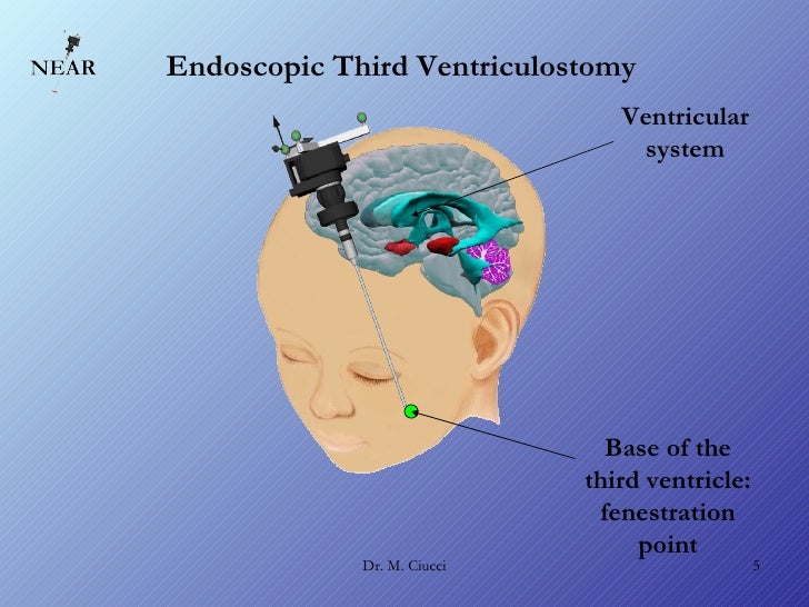 The NEAR Project: Neuroendoscopy towards Augmented Reality