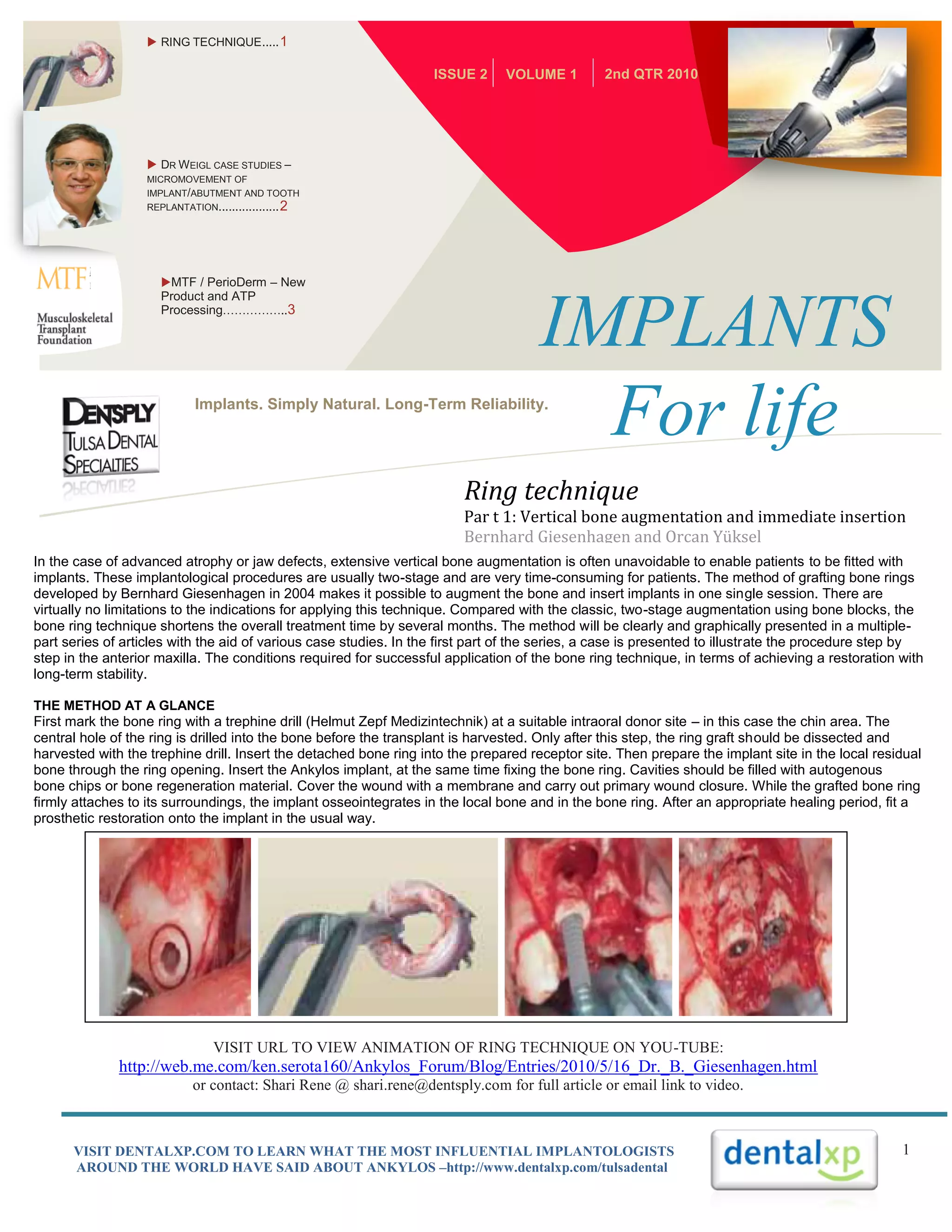 Implants For Life- Vol 2 | PDF | Dental Health | Diseases and Conditions