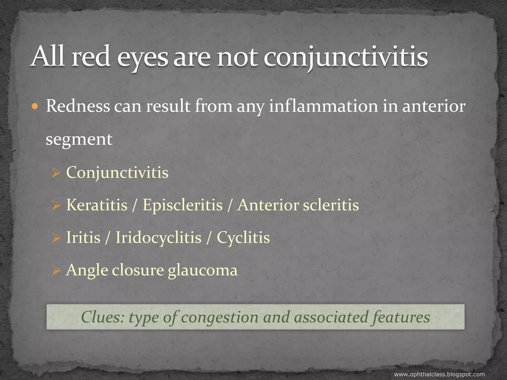 Overview of uveitis - Part2 Clinical features | PPT