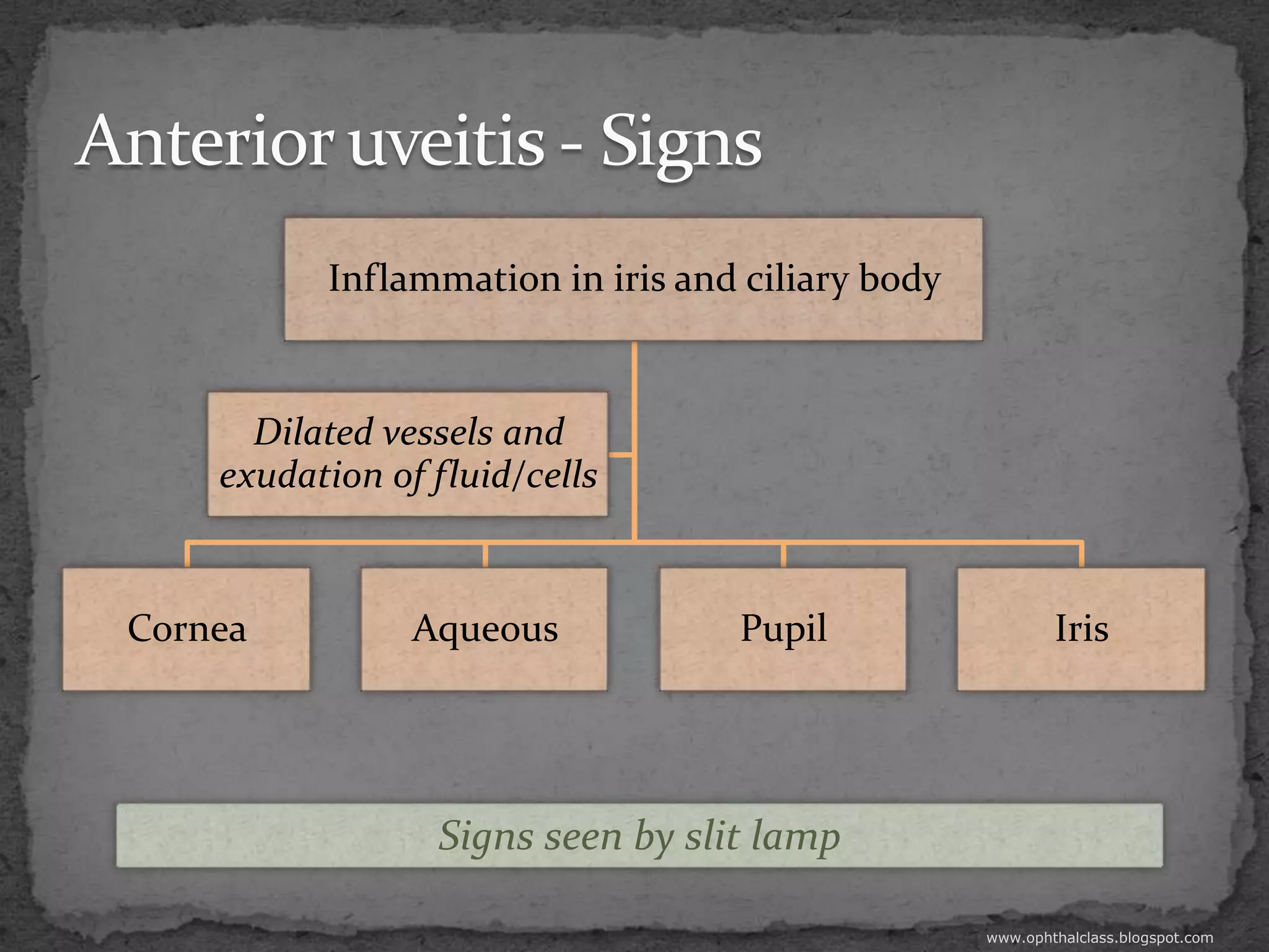 Overview of uveitis - Part2 Clinical features | PPT