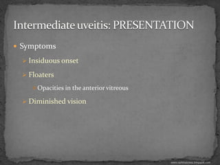 Overview of uveitis - Part2 Clinical features | PPTX