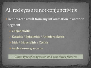 Overview of uveitis - Part2 Clinical features | PPTX