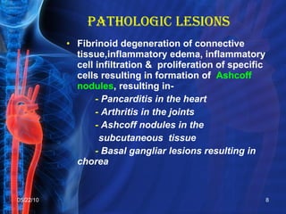 Rheumatic Fever by Adnan Bhutto | PPT