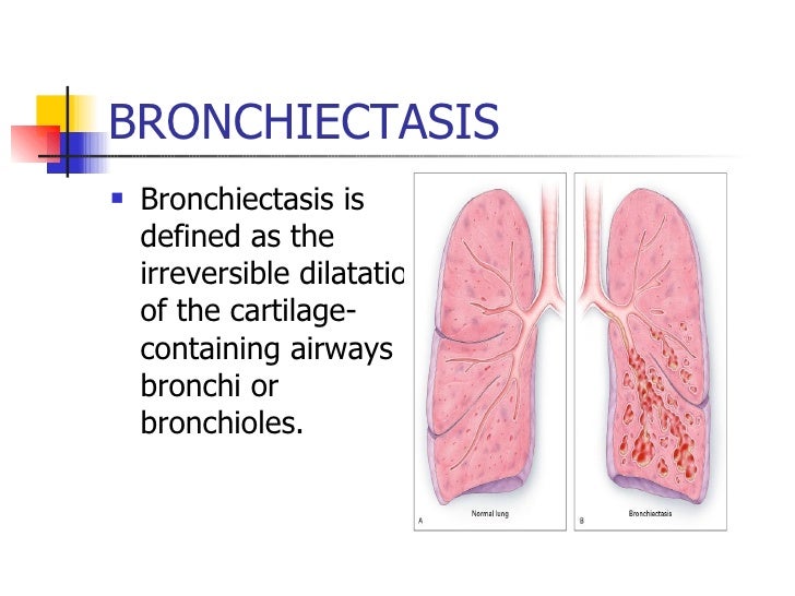 PATHOGENESIS OF BRONCHIECTASIS BY DR BASHIR AHMED DAR ASSOCIATE PROFE…