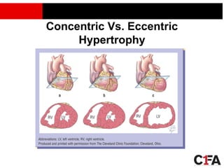 CFA Team Training (CrossFit) | PPT | Free Download