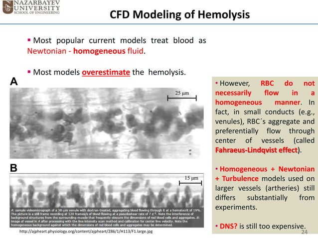 CFD Modeling of Hemolysis in Medical Devices used in the Treatment of Cardiovascular Disease ...