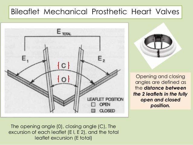 Role of cinefluoroscopy in prosthetic valve disease
