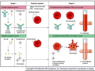 COMPLEMENT FIXATION TEST - CFT | PPTX