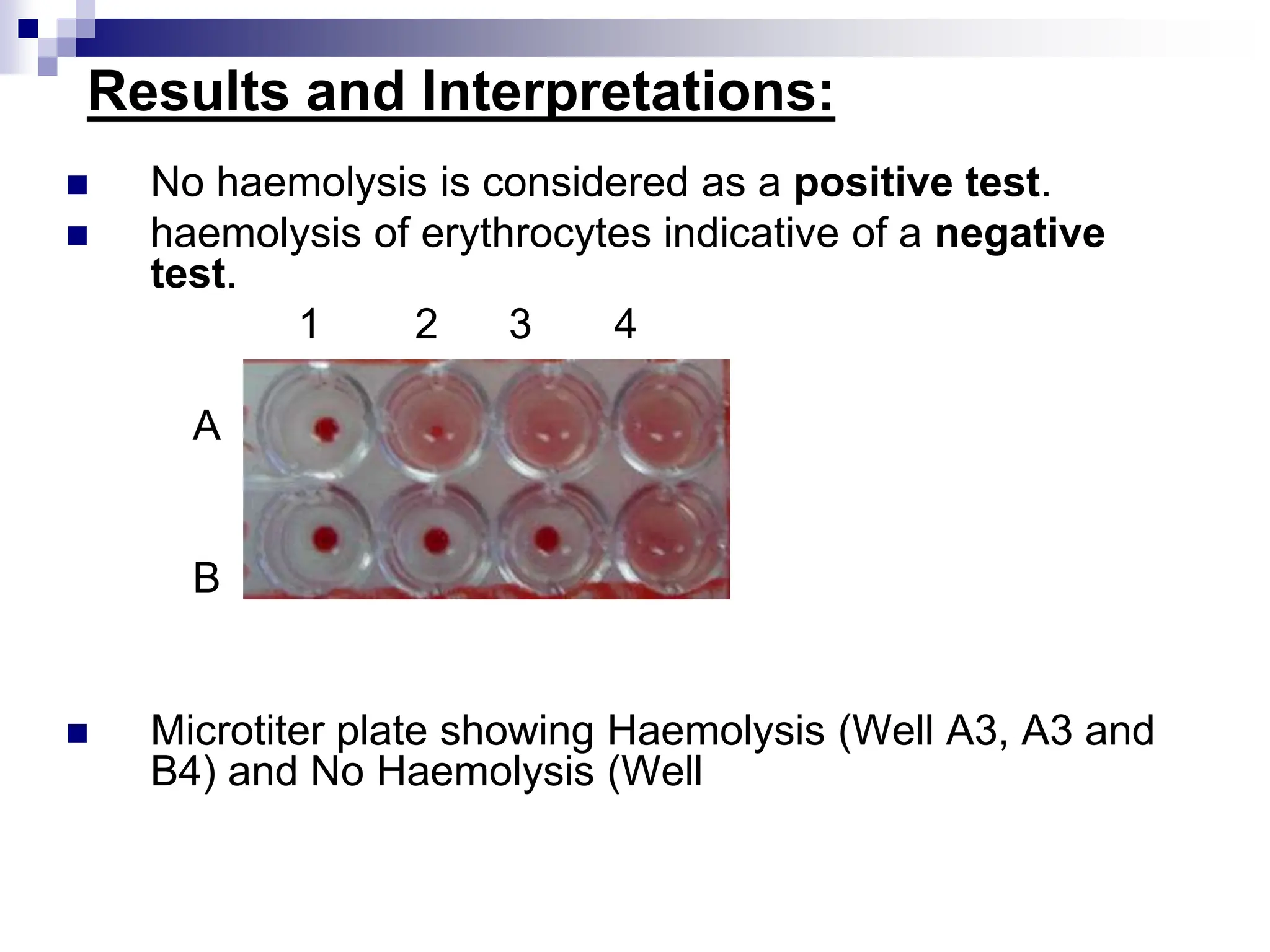PRACTICAL 18: COMPLEMENT FIXATION TEST.ppt
