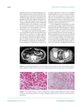 Tuberculosis extrapulmonar que se presenta como un absceso inguinal | PDF