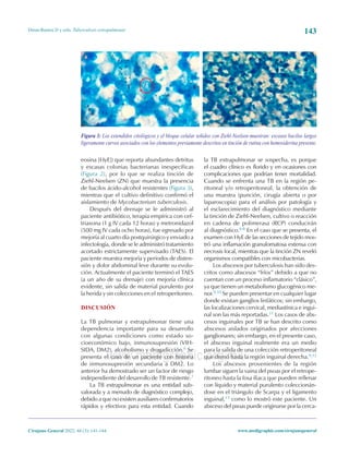 Tuberculosis extrapulmonar que se presenta como un absceso inguinal | PDF