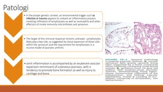JUVENILE_PSORIATIC_ARTHRITIS.ppt
