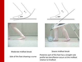Cga ifa 2015 14 foot models | PPTX