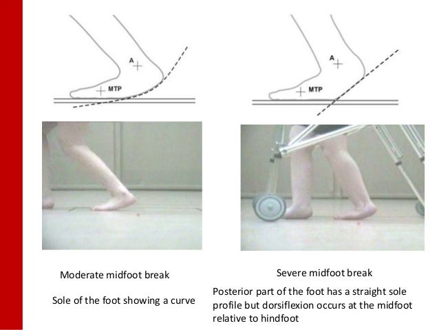 Cga ifa 2015 14 foot models