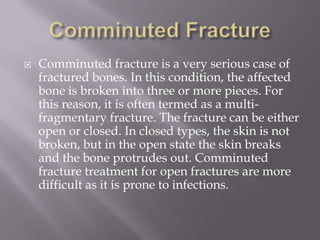 SP14 BIO120 CH4 Fractures | PPT