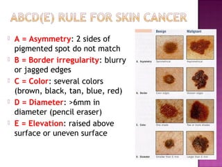 Ch. 5 integumentary system - part 3 | PPT